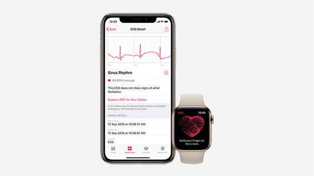 How does the heart rate monitor on my Apple Watch work? | Coolblue ...